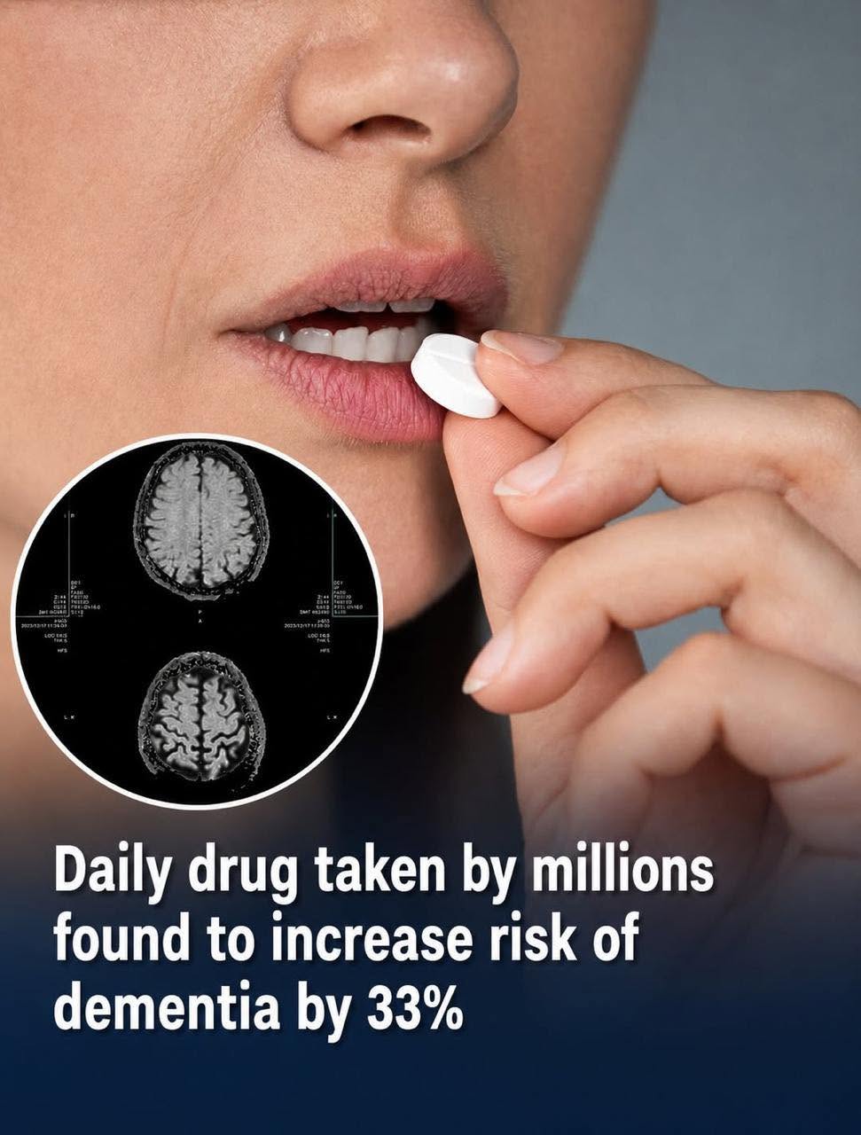 Millions Take This Daily Pill — And It May Raise Dementia Risk by 33% ...